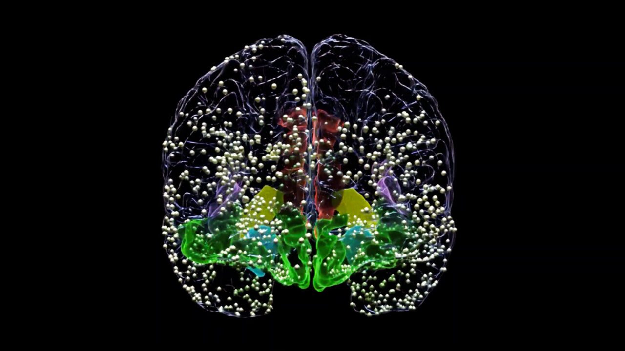 Brain Mapping, Neurofeedback, Neurostimulation and Neuromodulation ...